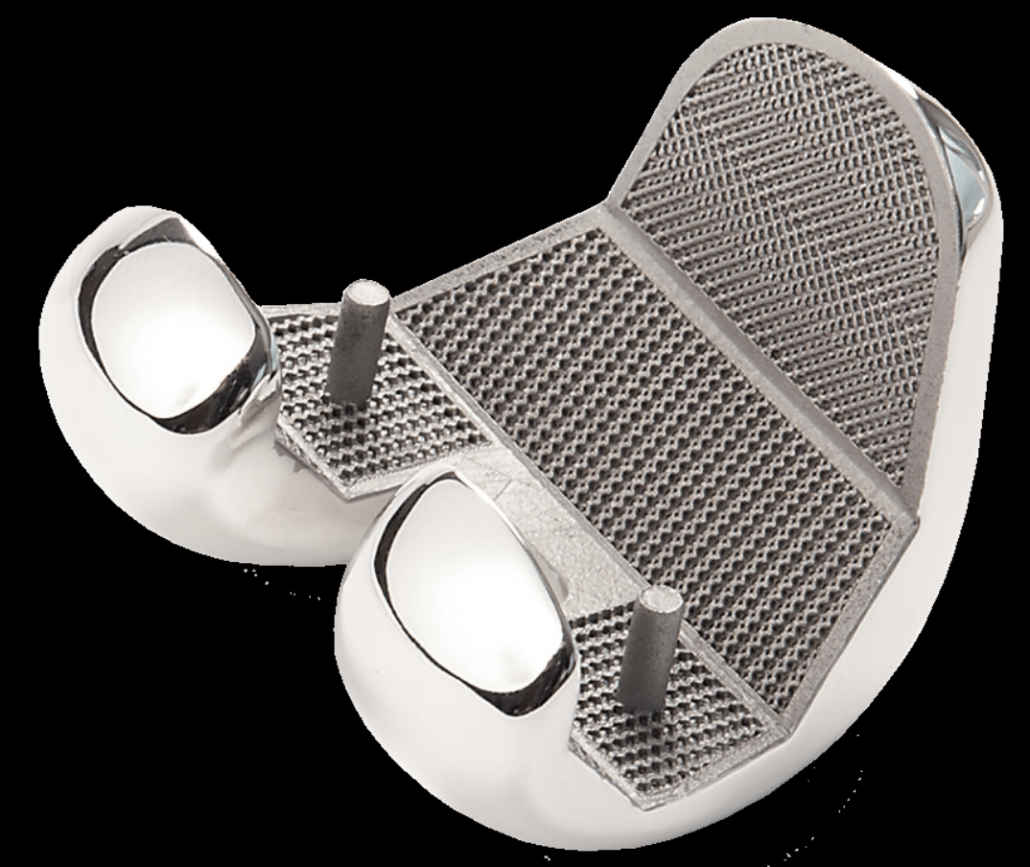 SLM® Medical and Dental Applications - Rapid Model